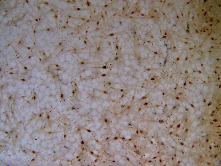 Postlarval stages of shrimp (Penaeus vannamei).